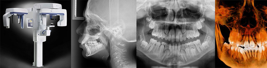 Zobni rentgen Trebnje | RTG slikanje zob in glave | ZoboEstetika d.o.o.